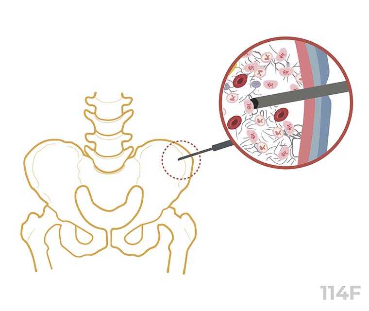 ITP » Diagnose & Untersuchungen | Leben mit ITP